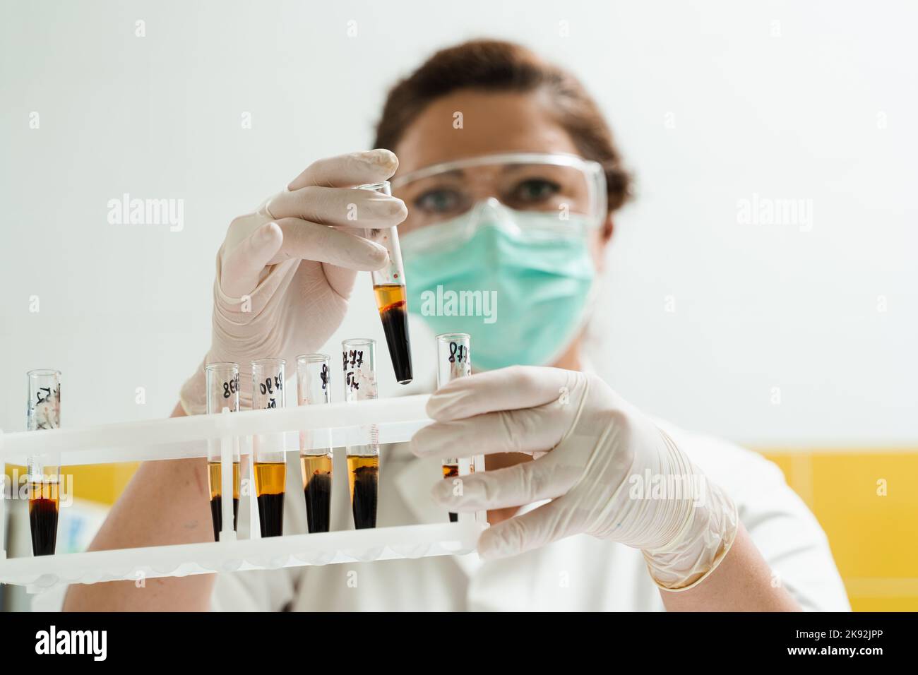 Analysis of blood plasma. The laboratory assistant holds a test tube ...