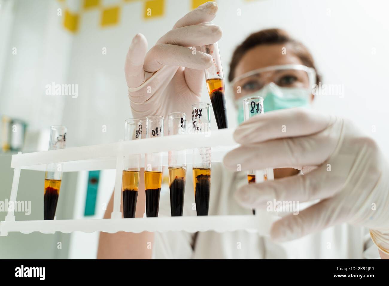 Analysis of blood plasma. The laboratory assistant holds a test tube ...
