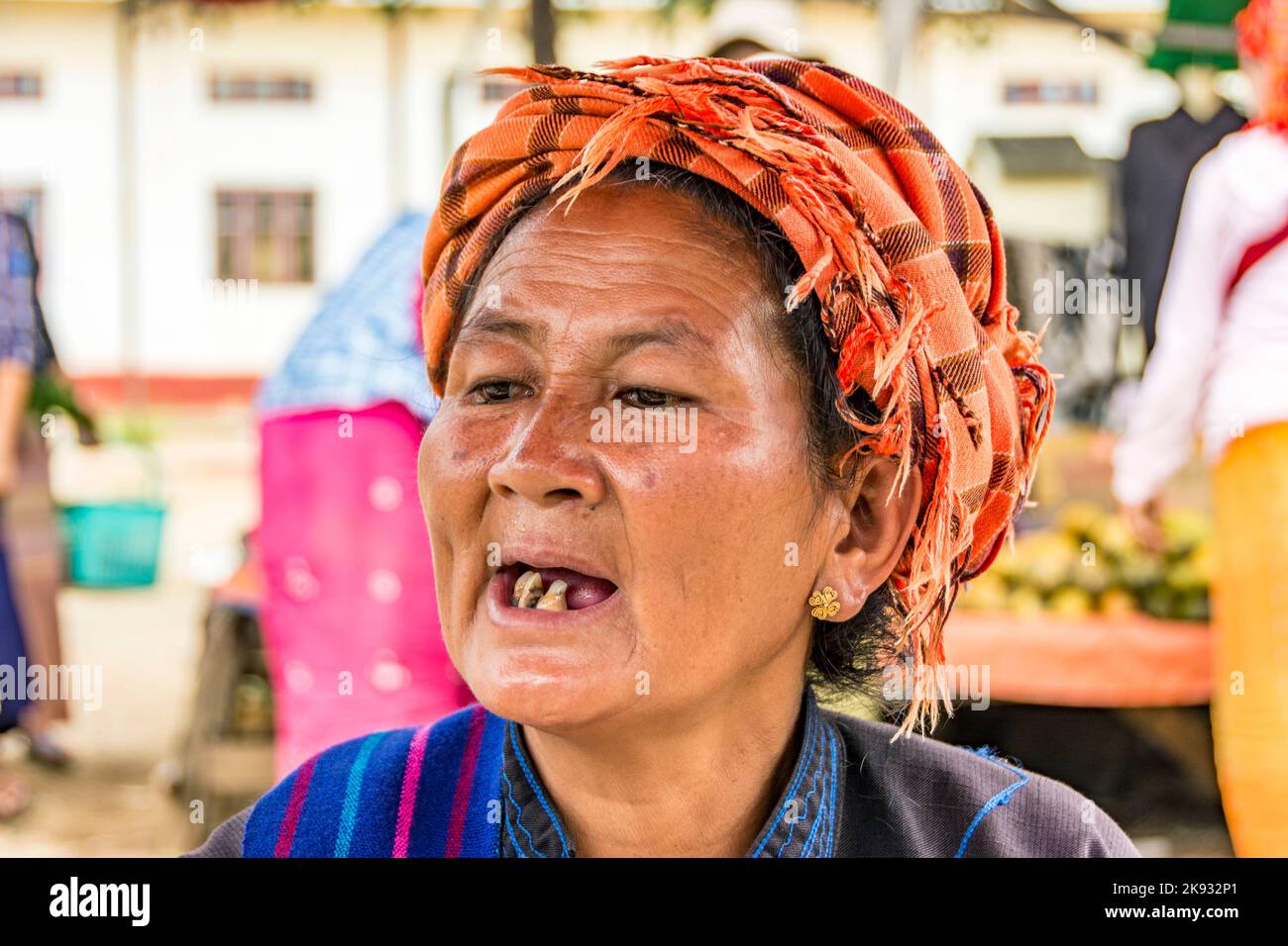 Missing teeth senior hi-res stock photography and images - Alamy