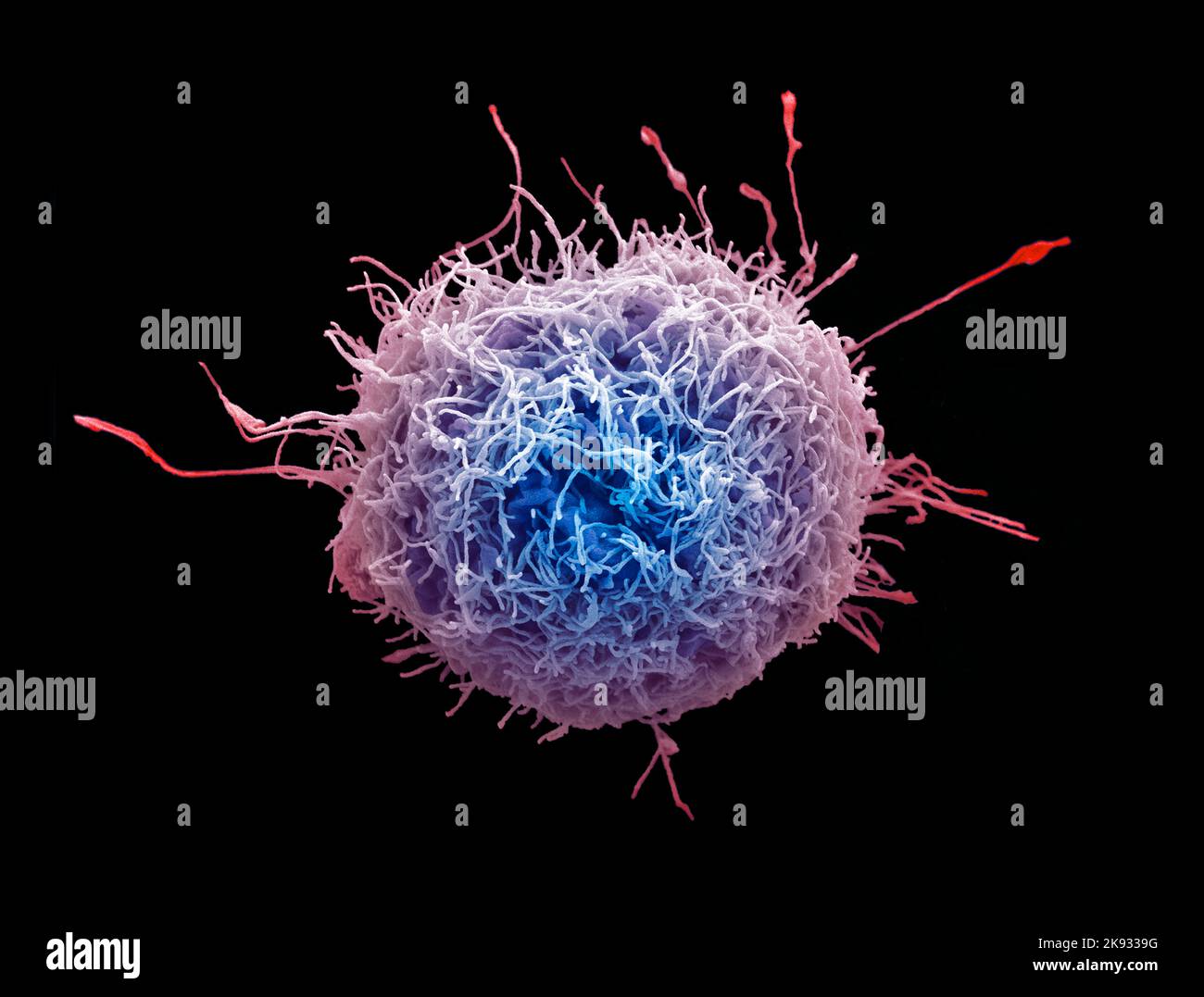 Cervical cancer cell, SEM Stock Photo - Alamy