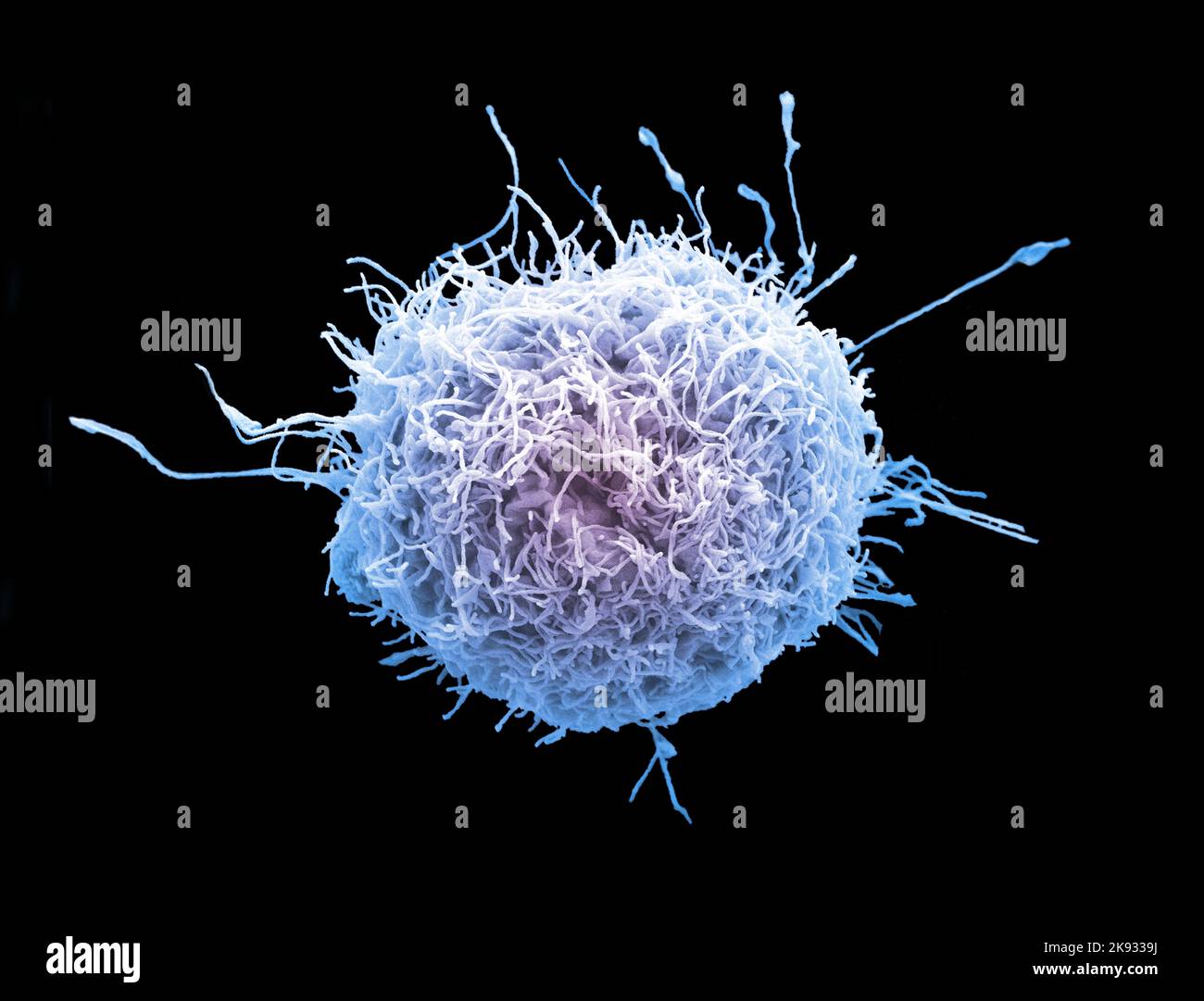 Cervical cancer cell, SEM Stock Photo - Alamy