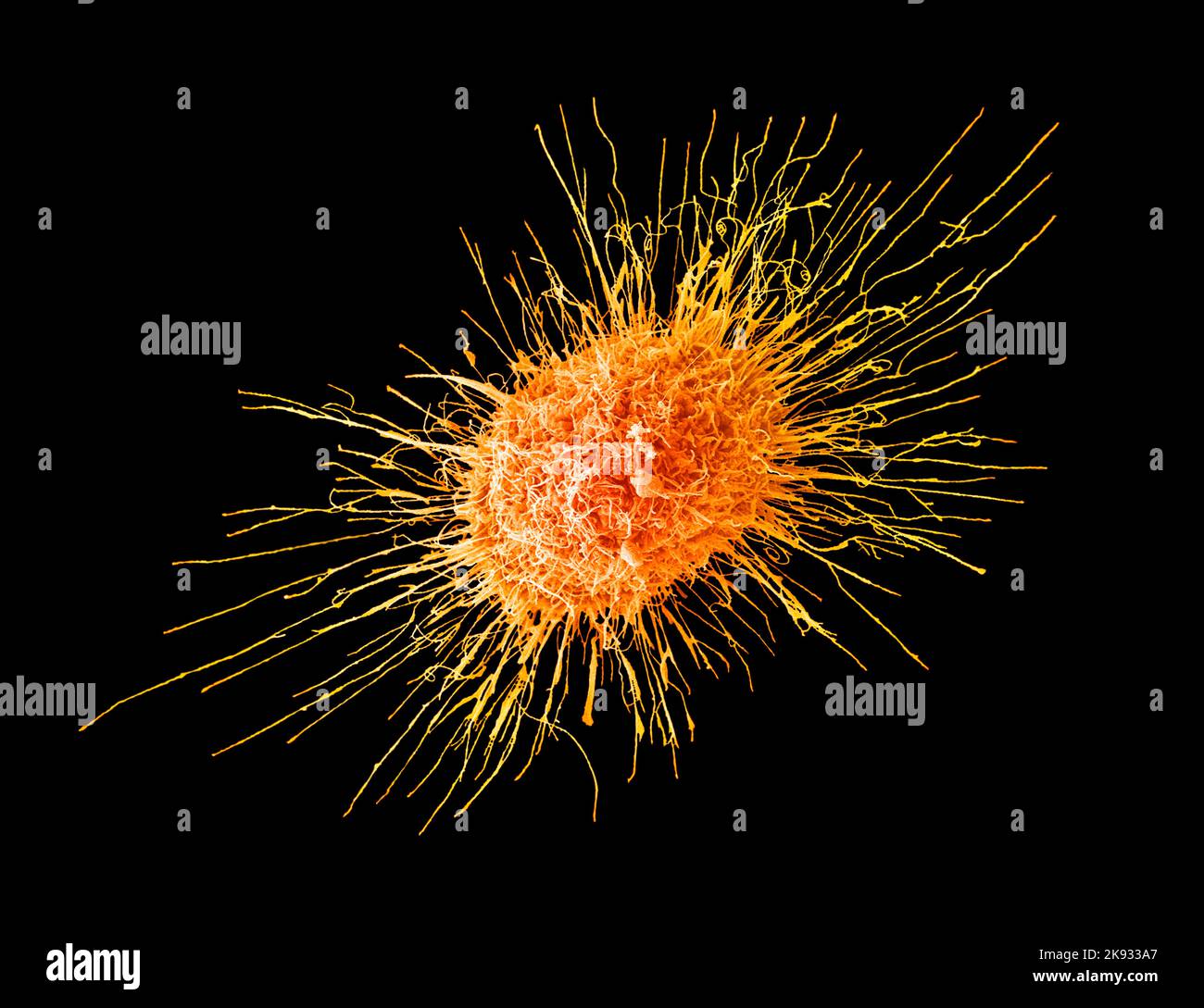 Cervical cancer cell, SEM Stock Photo - Alamy