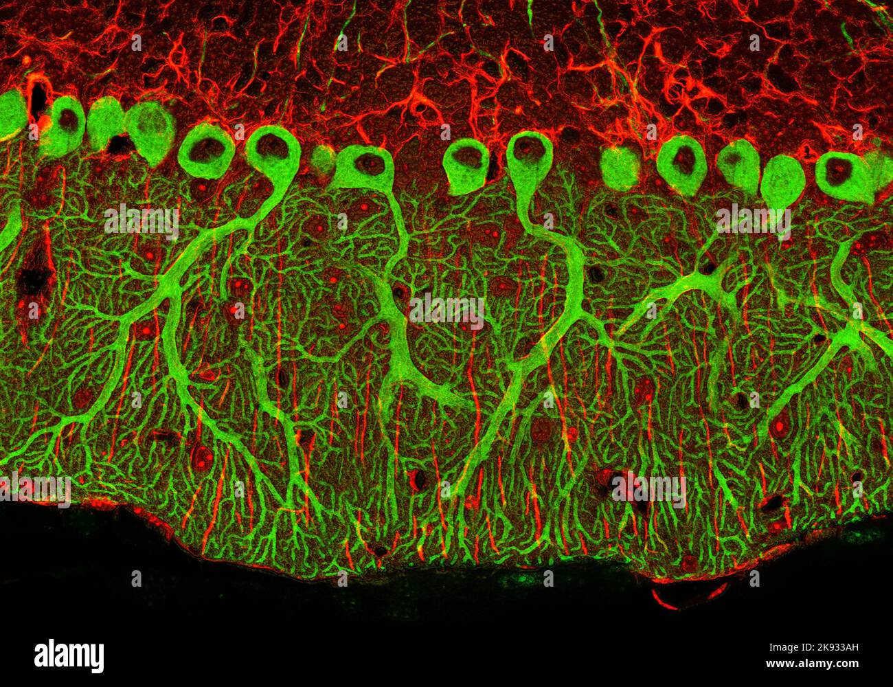 Cerebellum tissue, light micrograph Stock Photo - Alamy