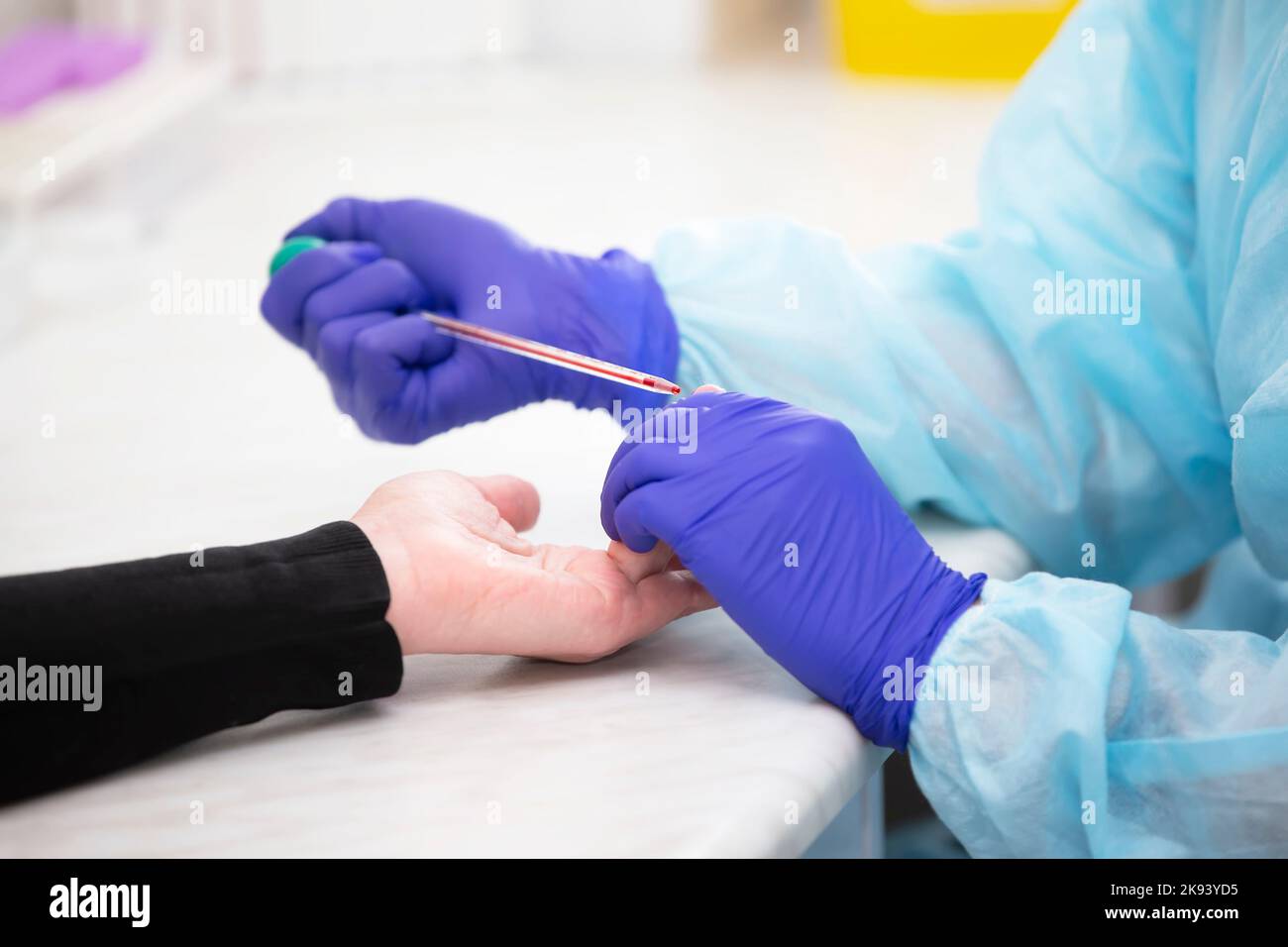 Taking blood for a general analysis, a clinical blood test. Collection ...