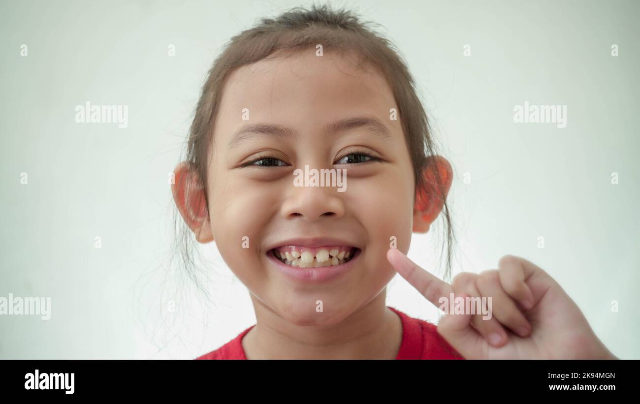 Happy Asian child in red showing her decayed teeth in selective focus ...