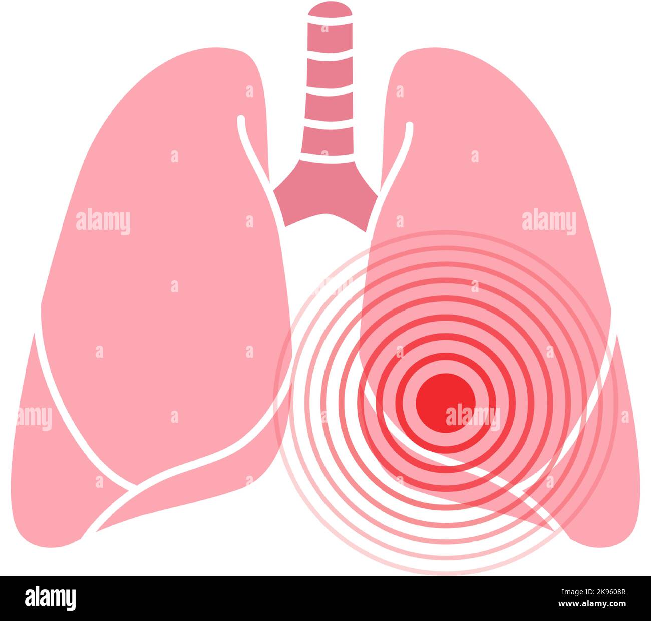 Human lungs pain symbol. Lungs ache icon. Vector illustration. Human ...