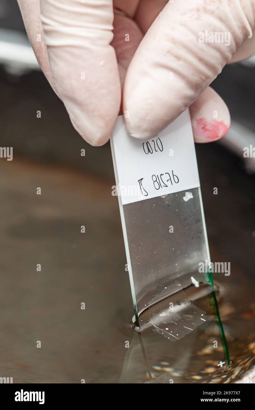 Scientist preparing a paraffin embedded tissue for pathology analysis. Floating method for ...