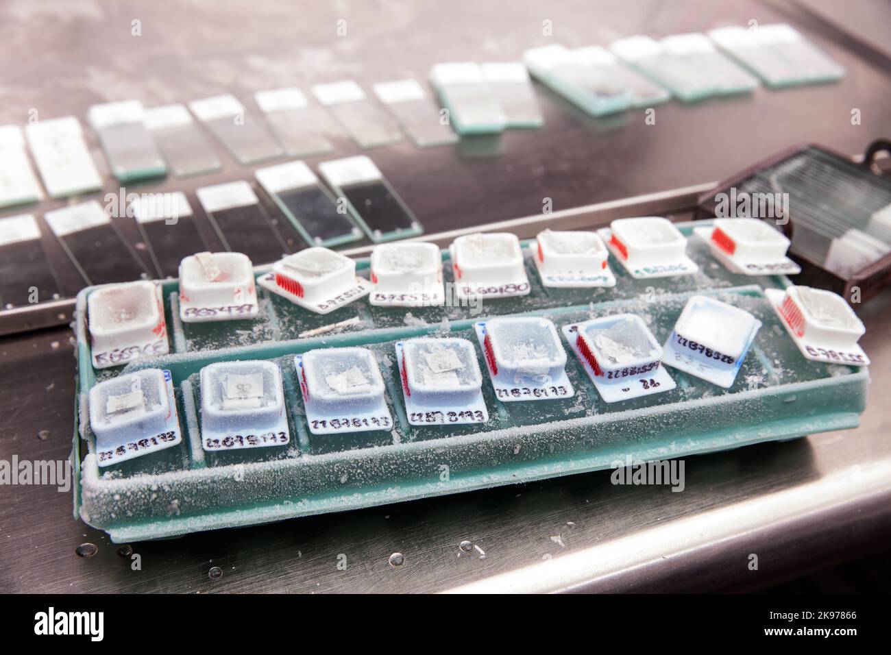 Frozen blocks of paraffin embedded tissue kept cold on ice ready to be ...