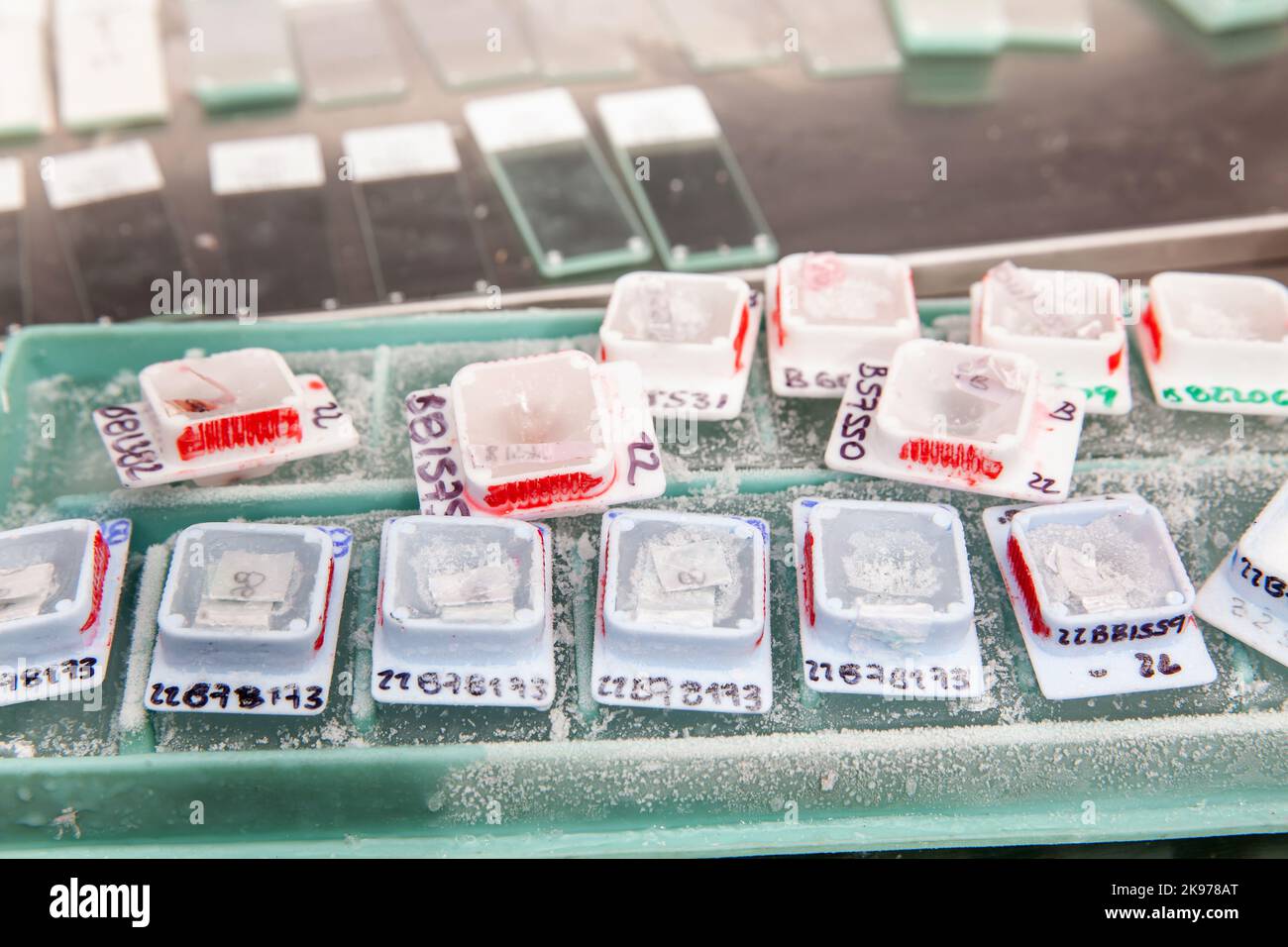 Frozen blocks of paraffin embedded tissue kept cold on ice ready to be ...