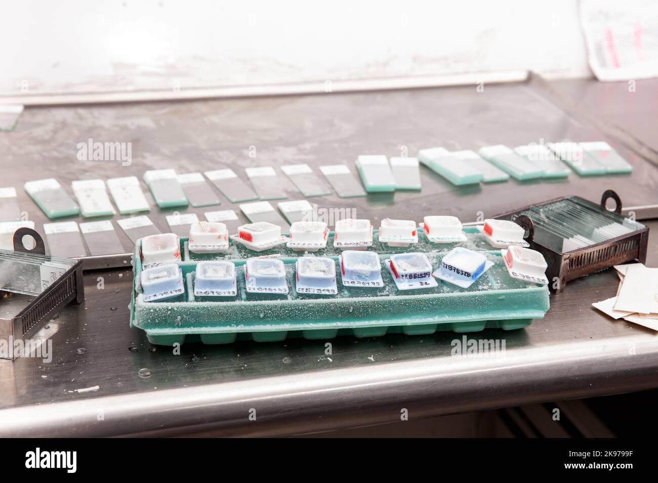 Frozen blocks of paraffin embedded tissue kept cold on ice ready to be ...