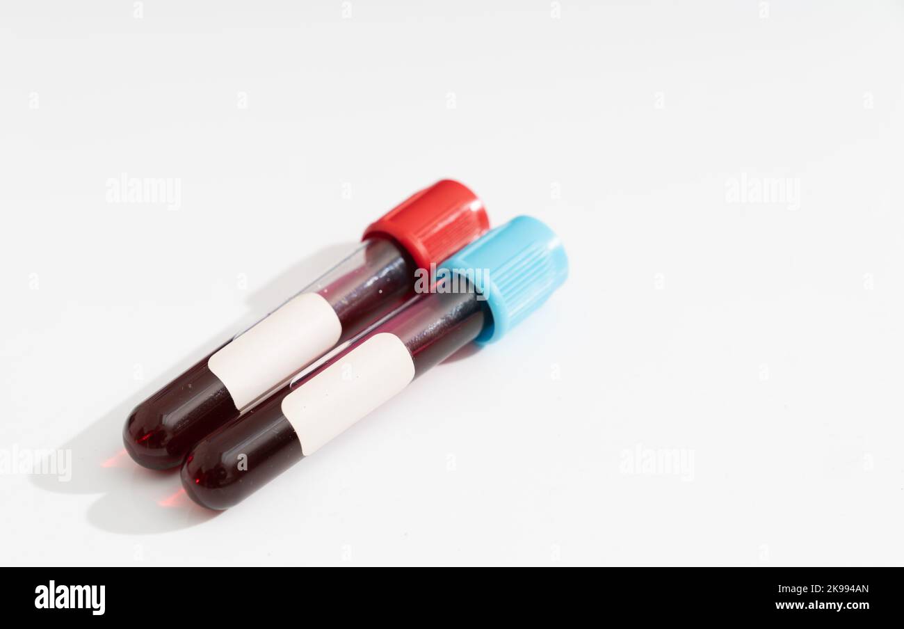 Two Test tube with empty label to biological sample for medical ...