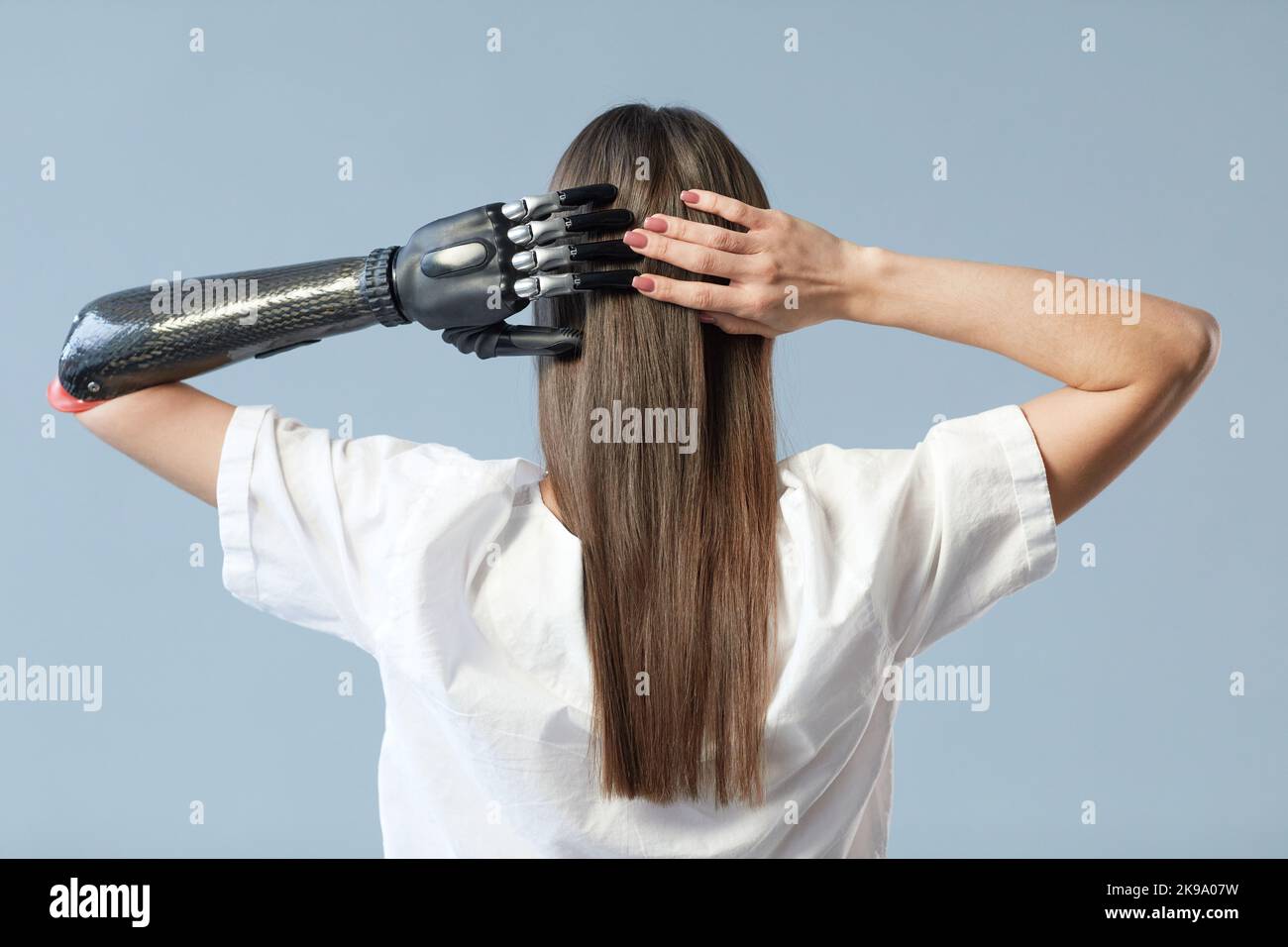 Rear view of young girl with prosthetic arm and long hair standing ...
