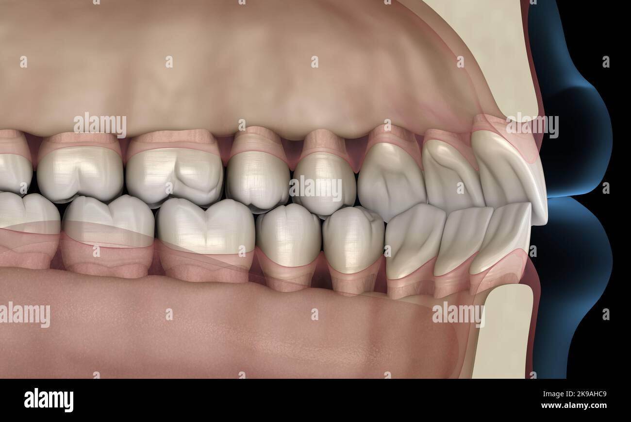 Healthy human teeth with normal occlusion, 3D Illustration Stock Photo ...