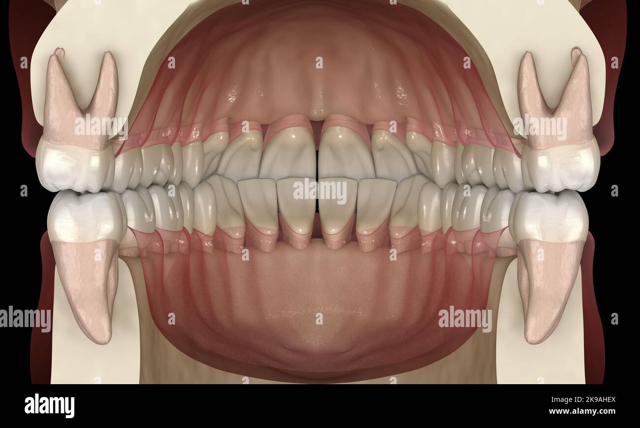 Healthy human teeth with normal occlusion, 3D Illustration Stock Photo ...