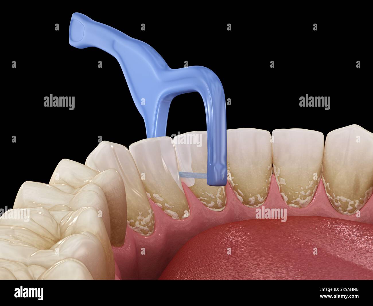 Oral hygiene: using toothpick dental floss to remove food stuck from ...