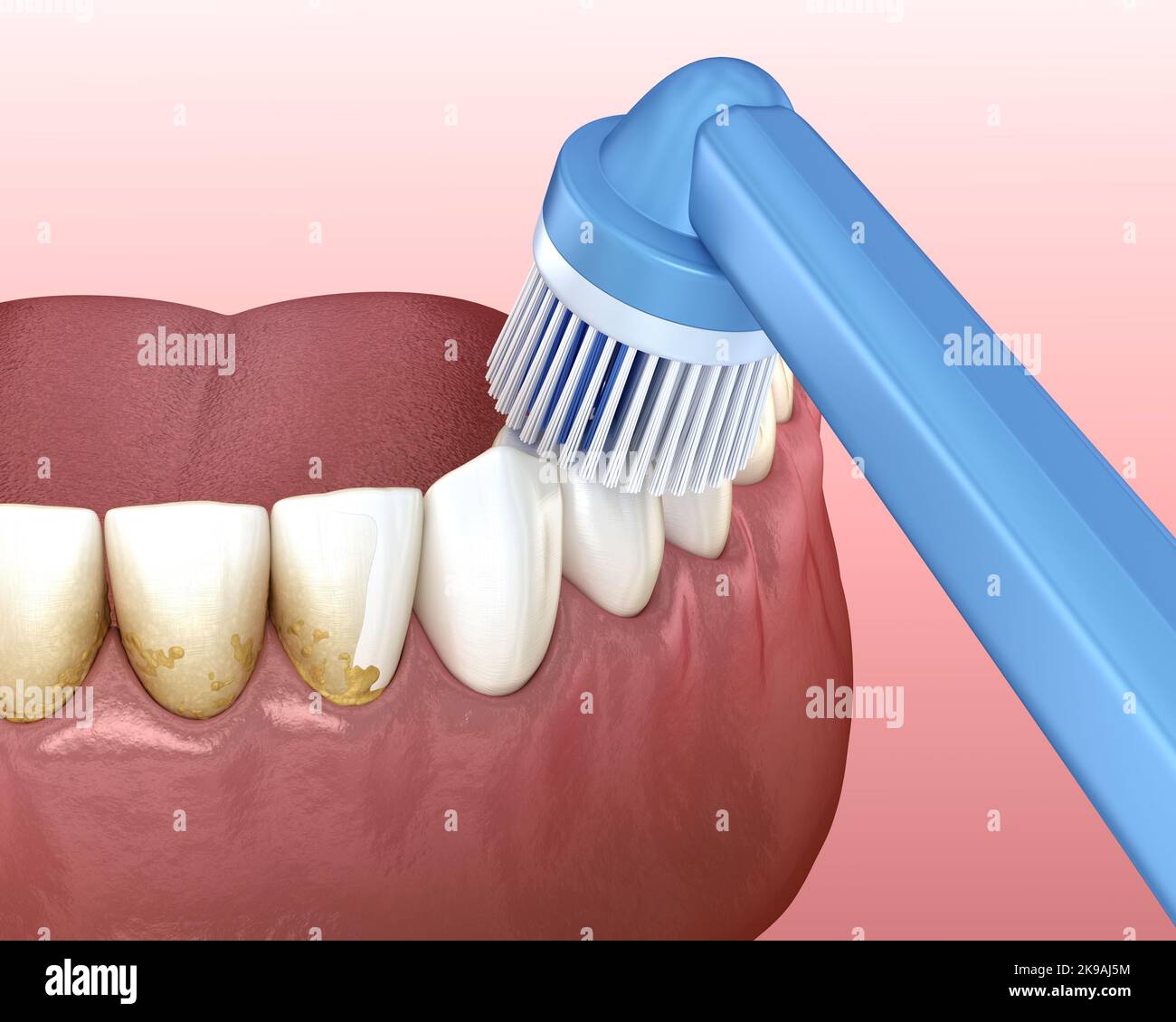 Electric Toothbrush cleaning teeth, Isolated on white. Medically ...