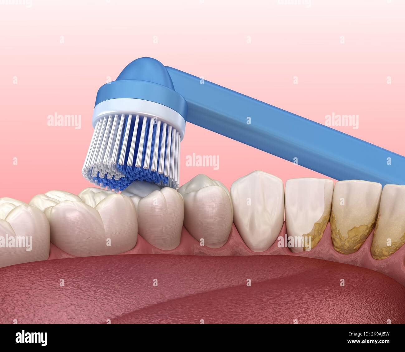Electric Toothbrush cleaning teeth, Isolated on white. Medically ...