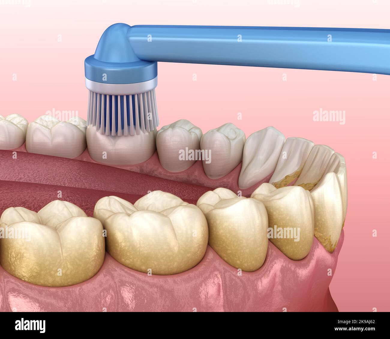 Electric Toothbrush cleaning teeth, Isolated on white. Medically ...