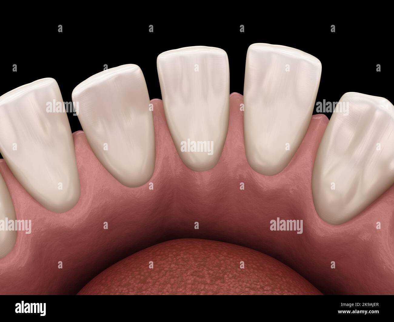 Teeth spacing hi-res stock photography and images - Alamy