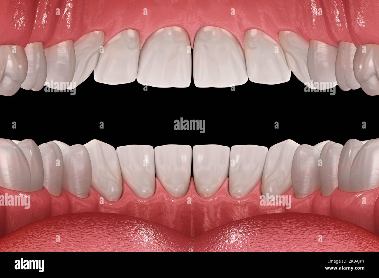 Healthy human teeth with normal occlusion, view form inside. Medically ...