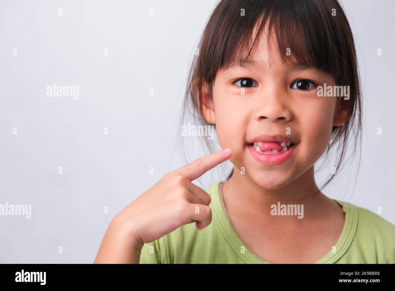 Portrait of an Asian girl with broken upper baby teeth and first ...