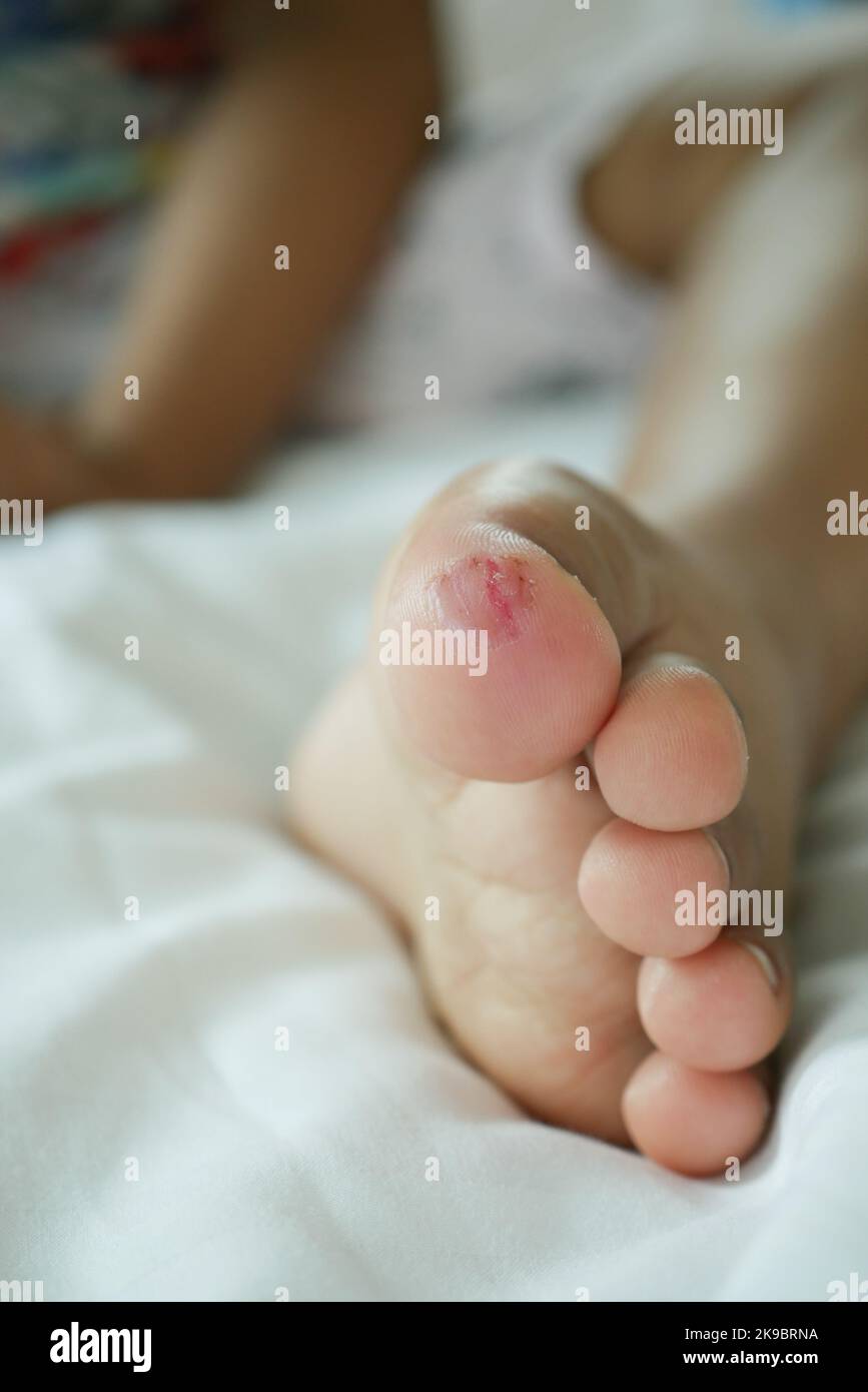 close up of 5 years old child dry feet on bed Stock Photo - Alamy