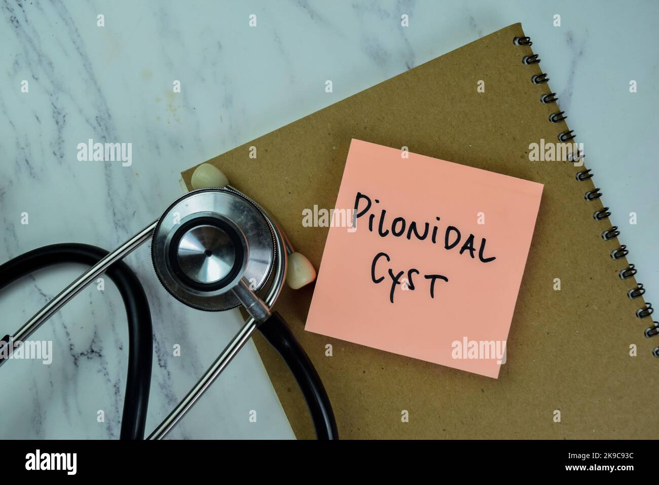 Concept Of Pilonidal Cyst Write On Sticky Notes With Stethoscope
