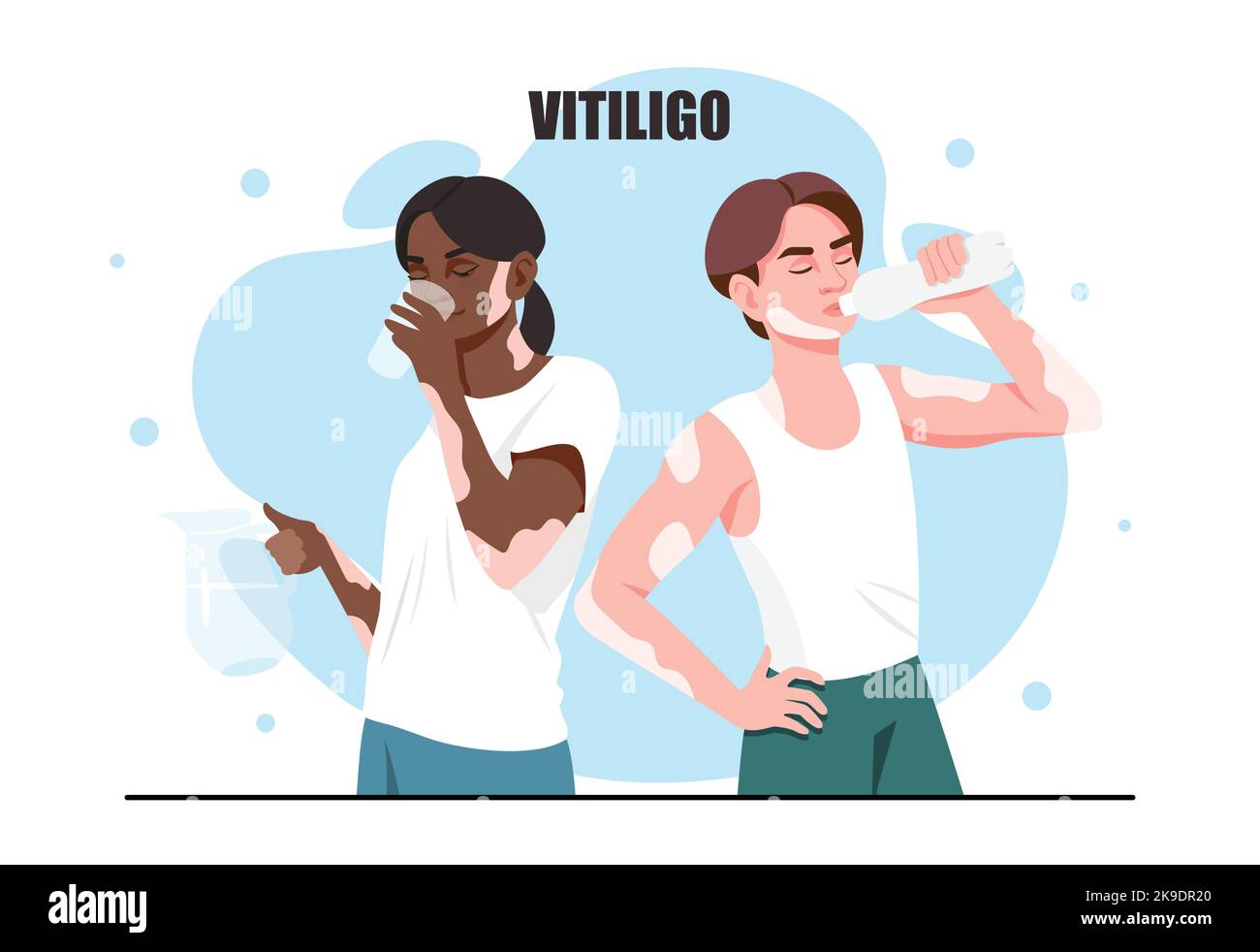 Vitiligo vector skin background Stock Vector Images - Alamy