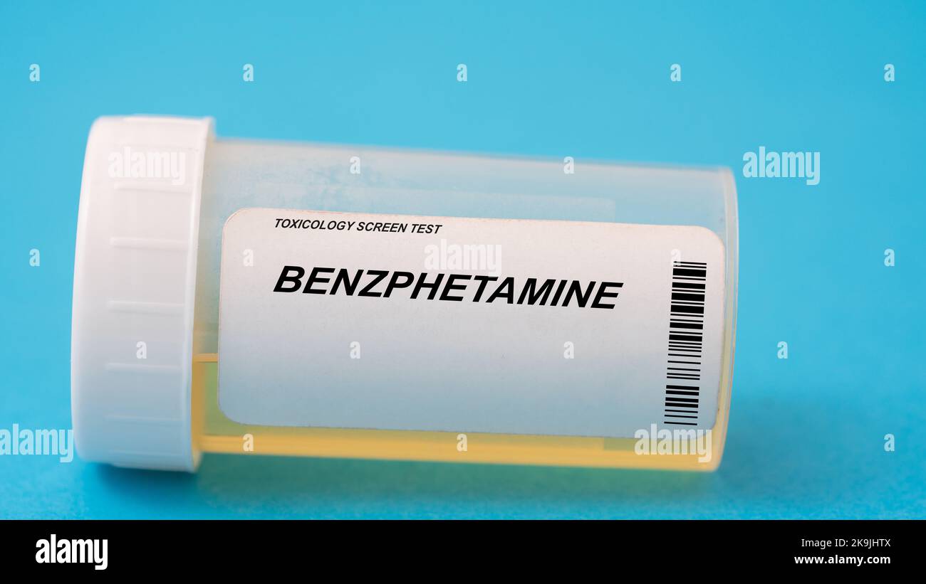 Urine test for benzphetamine Stock Photo - Alamy
