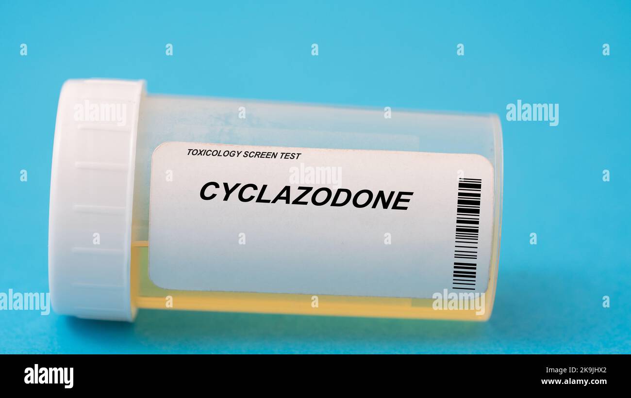 Urine test for cyclazodone Stock Photo - Alamy