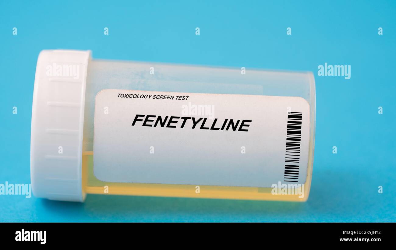 Urine test for fenetylline Stock Photo - Alamy