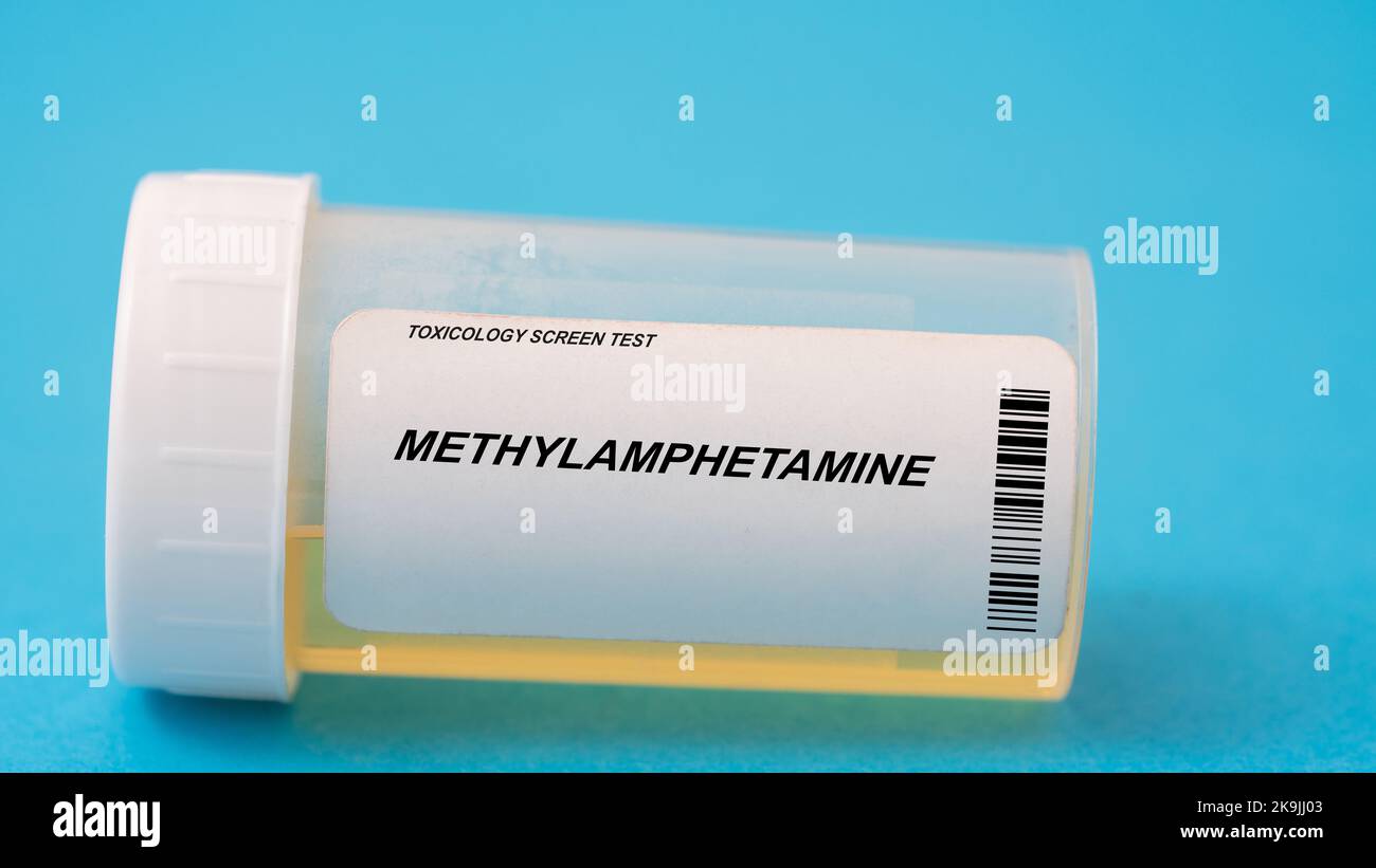 Urine test for methylamphetamine Stock Photo - Alamy