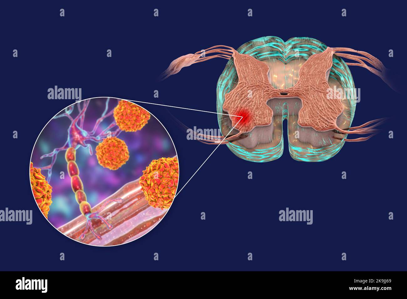 Motor neurons spinal hi-res stock photography and images - Alamy