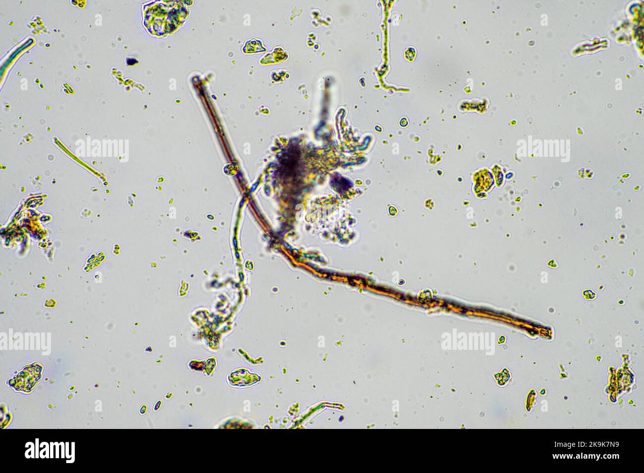 Fungal and fungi hyphae under the microscope in the soil and compost ...