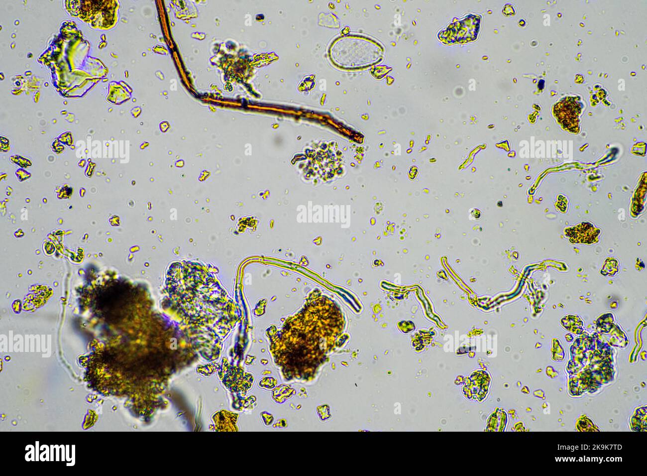 Fungal and fungi hyphae under the microscope in the soil and compost ...