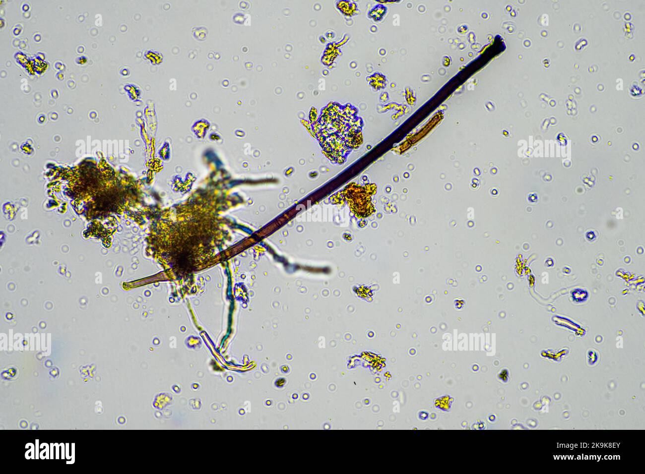 Fungal and fungi hyphae under the microscope in the soil and compost, in a soil biology and ...