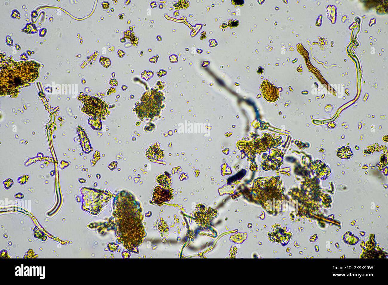 soil sample under the microscope. soil fungi and microorganisms cycling ...