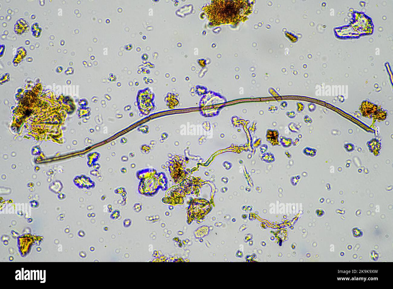 soil sample under the microscope. soil fungi and microorganisms cycling ...