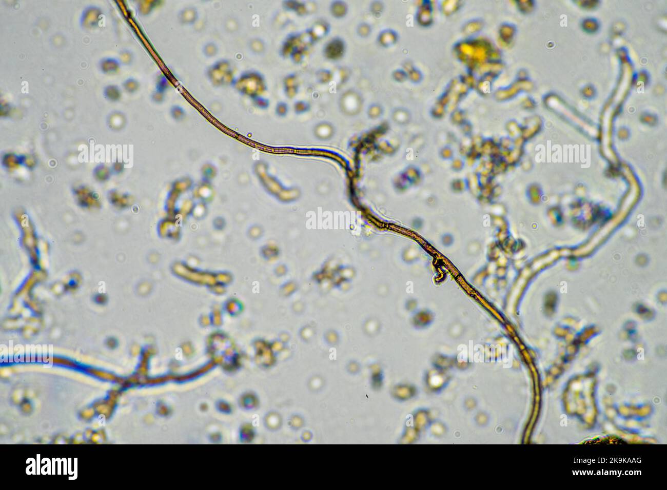 soil sample under the microscope. soil fungi and microorganisms cycling ...