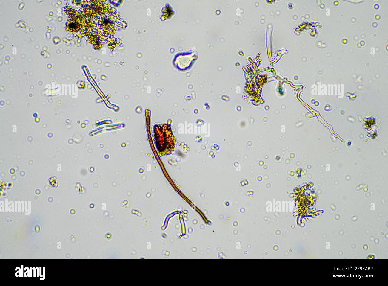 soil sample under the microscope. soil fungi and microorganisms cycling ...