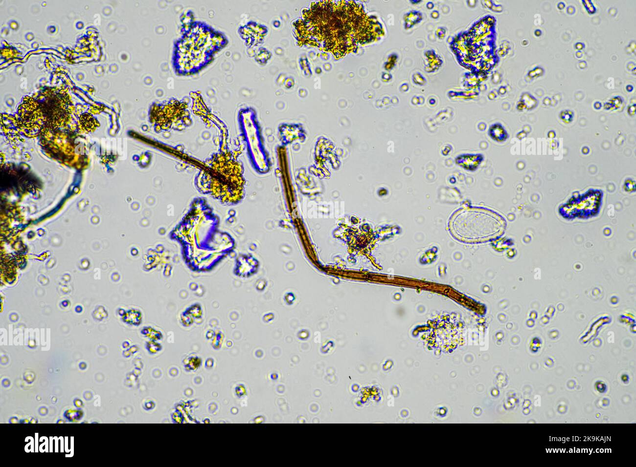 soil sample under the microscope. soil fungi and microorganisms cycling ...