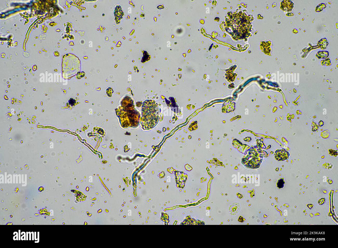soil sample under the microscope. soil fungi and microorganisms cycling ...