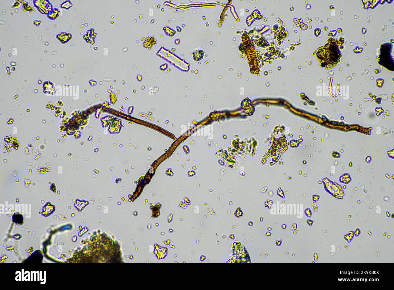 soil sample under the microscope. soil fungi and microorganisms cycling ...