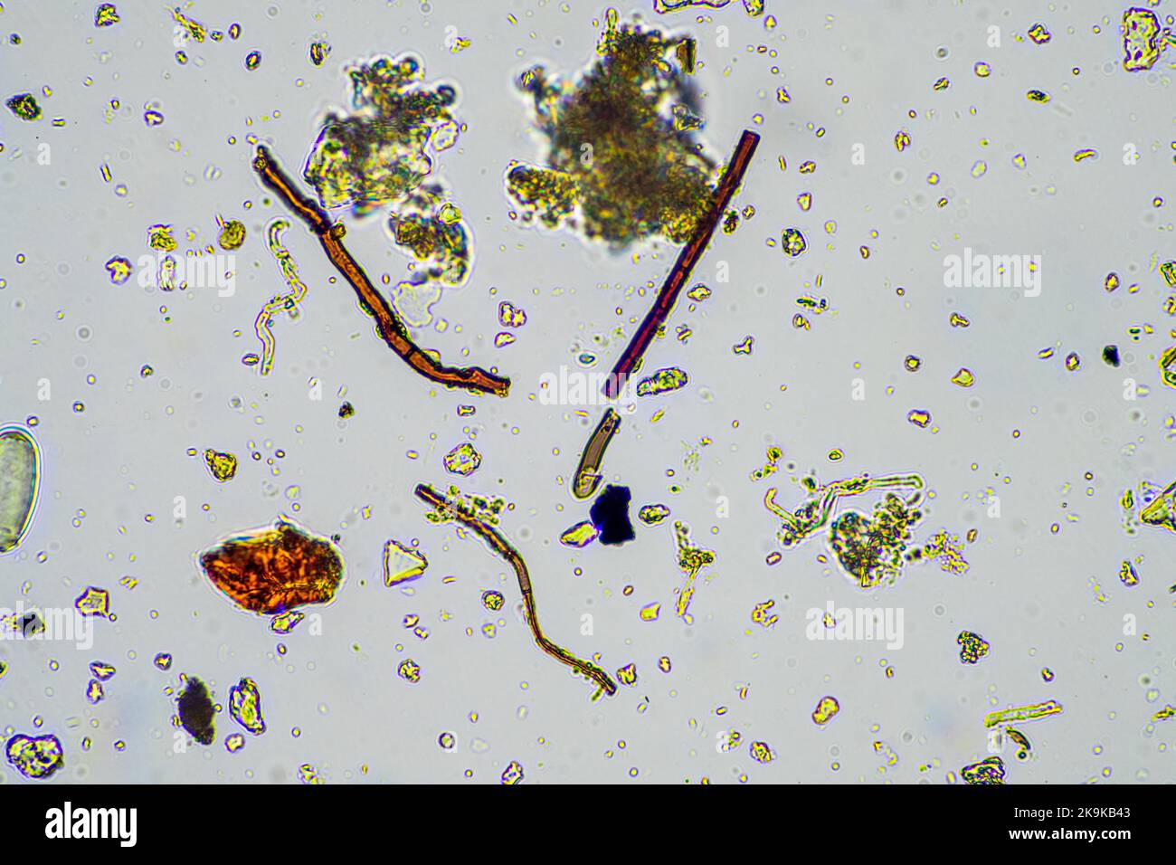 soil sample under the microscope. soil fungi and microorganisms cycling ...