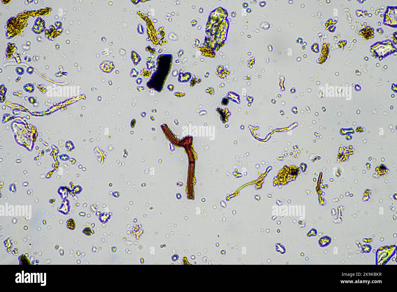 soil sample under the microscope. soil fungi and microorganisms cycling ...