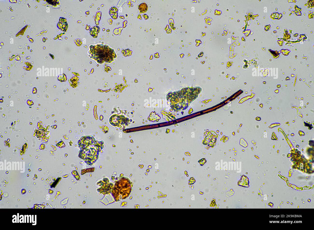 soil sample under the microscope. soil fungi and microorganisms cycling ...
