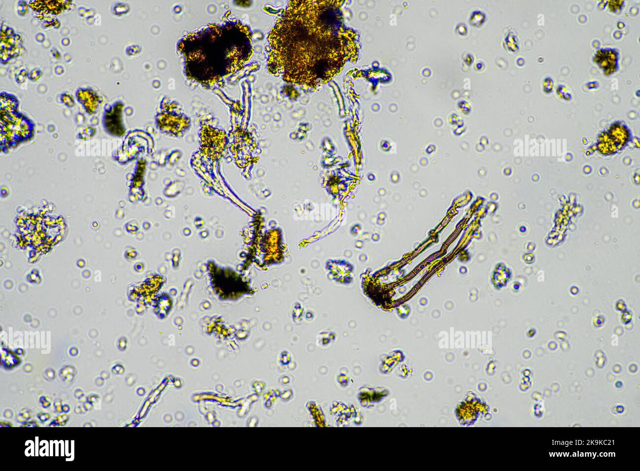 soil sample under the microscope. soil fungi and microorganisms cycling ...