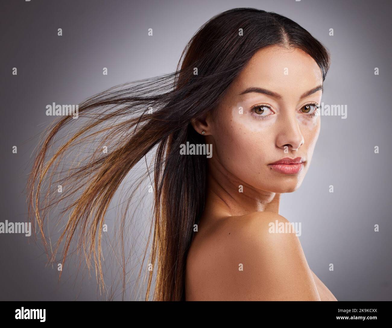 Beauty, face and vitiligo with a model woman in studio on a gray ...