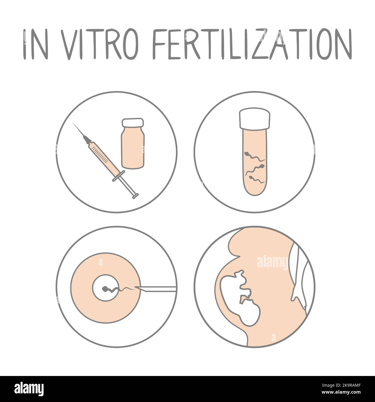 In vitro fertilization icon set. Linear simple illustration pregnancy ... In vitro fertilization icon set. Linear simple illustration pregnancy ...