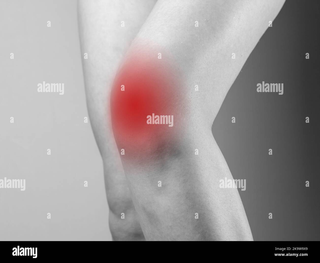 Knee cap ache, pain. Broken meniscus hurting, trauma close up ...